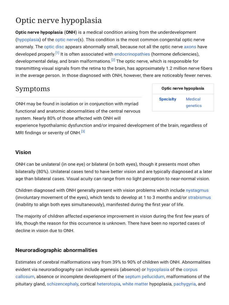 Optic Nerve Hypoplasia Wikipedia Pdf Human Diseases And Disorders