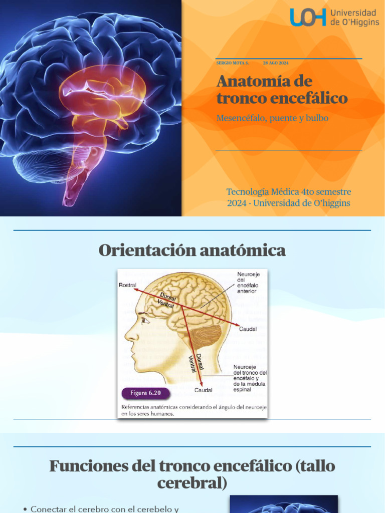 Clase Anatom A de Tronco Encef Lico | PDF | Cerebro | Tronco encefálico