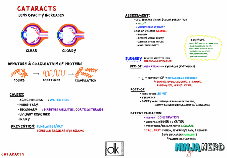 20130040_Nursing_Pathology_004_Cataracts_NCLEX_Illustrations_Handout | PDF