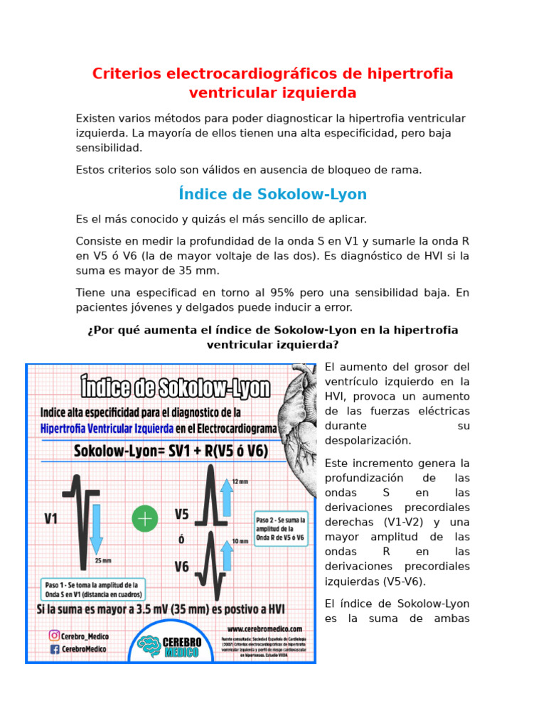 Criterios Electrocardiográficos de Hipertrofia Ventricular Izquierda ...