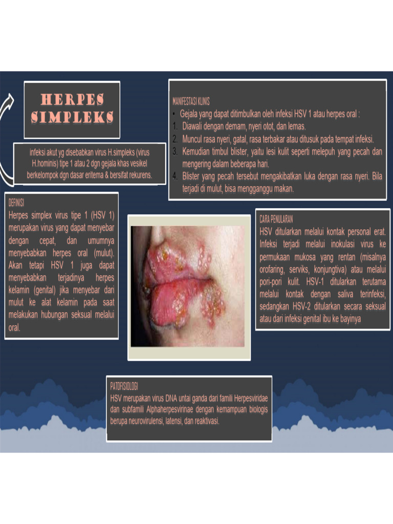 Herpes Simpleks | PDF