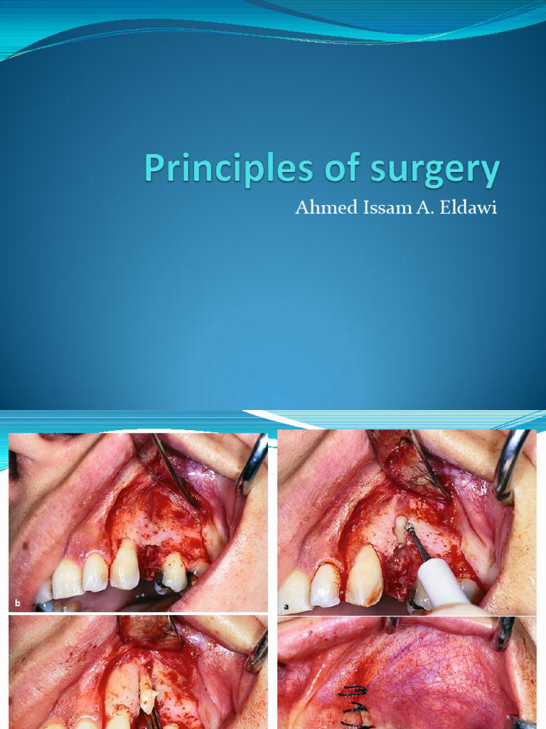 Principles of Surgery | PDF | Surgery | Surgical Suture