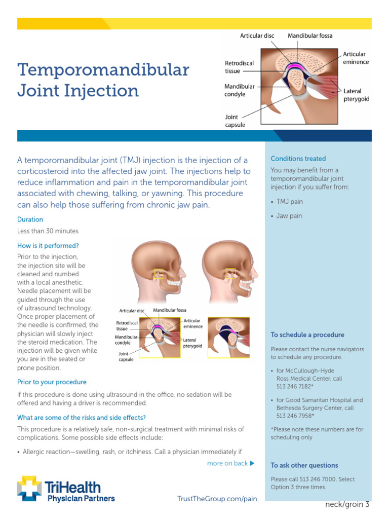 temporomandibular-joint-injection | PDF | Injection (Medicine) | Pain