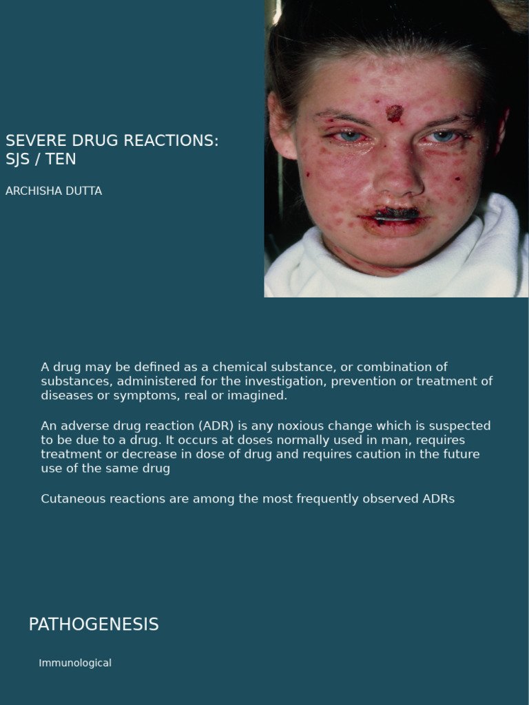 Severe Drug Reactions: SJS and TEN Overview | PDF | Immunology ...