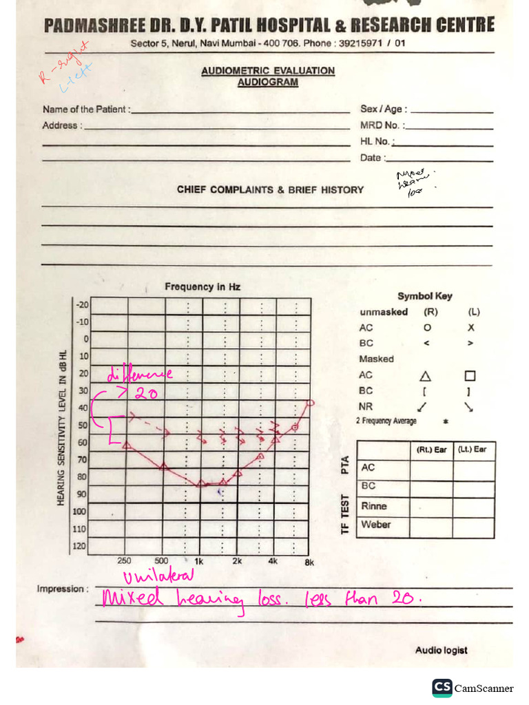 Audiogram | PDF