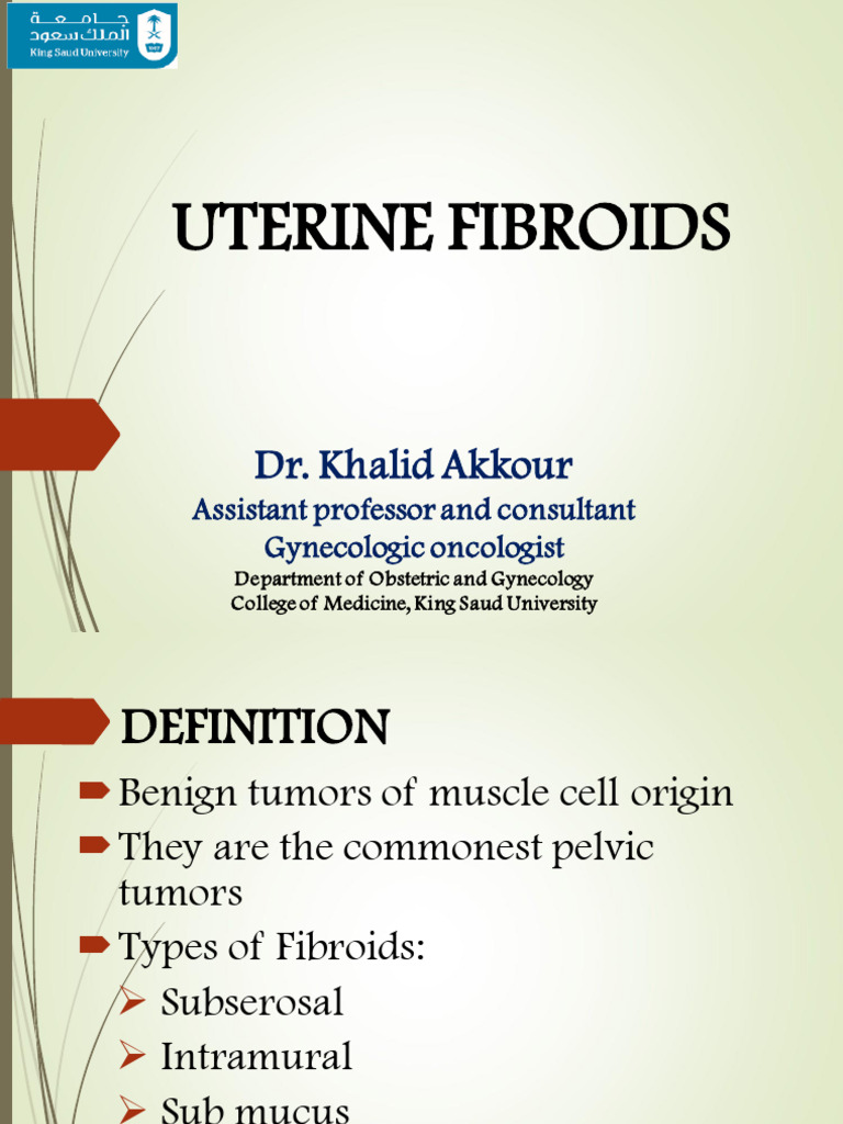 Uterine Fibroids - DR - Khalid | PDF