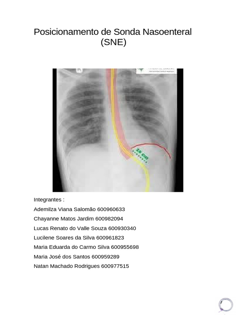 Posicionamento de Sonda Nasoenteral | PDF