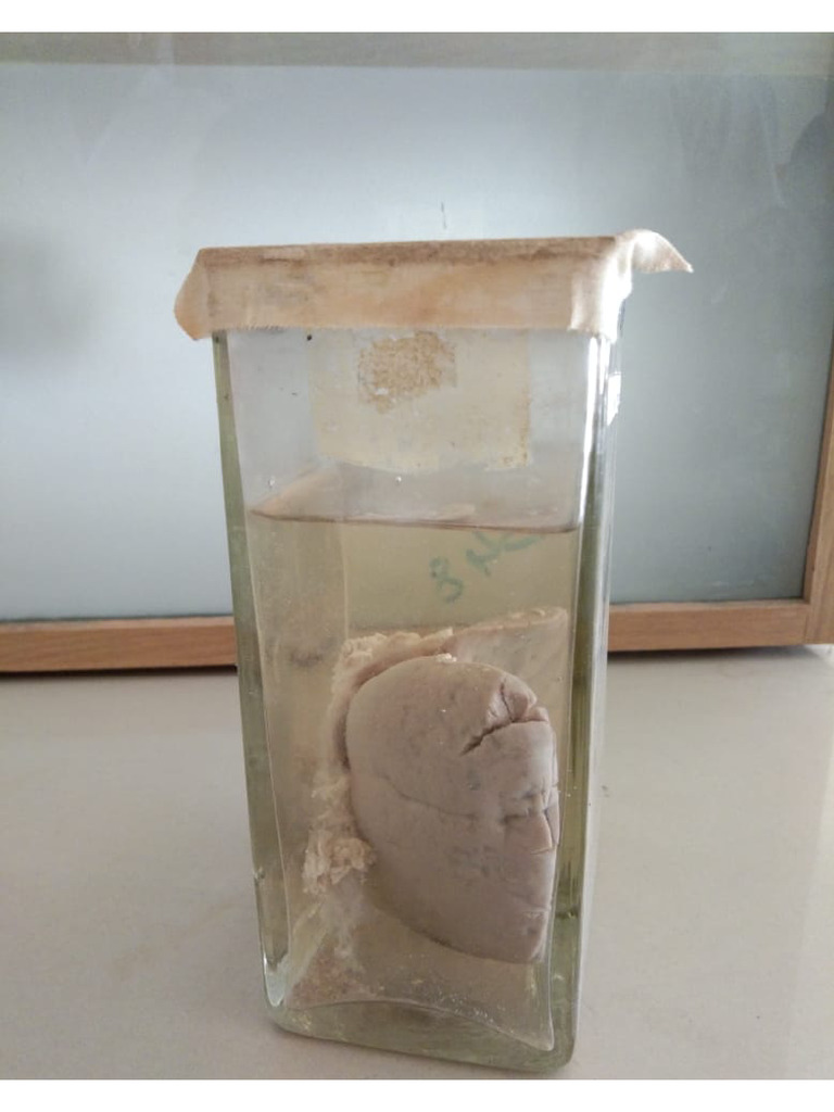 Patho Specimens | PDF