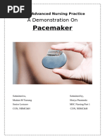 Abbott Pacel | PDF | Artificial Cardiac Pacemaker | Heart