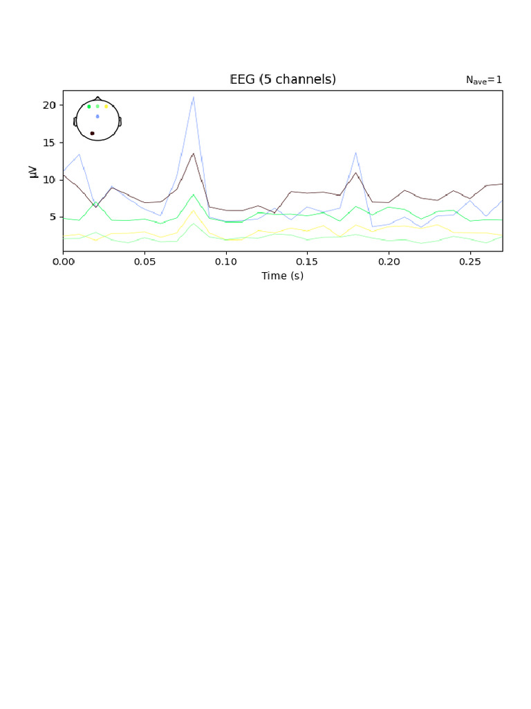 EEG Analysis Report Enhanced | PDF