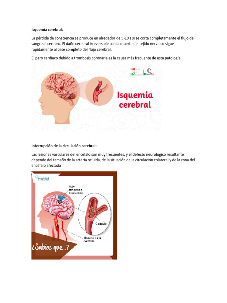 Causas y efectos de la isquemia cerebral | PDF | Trombosis | Embolia
