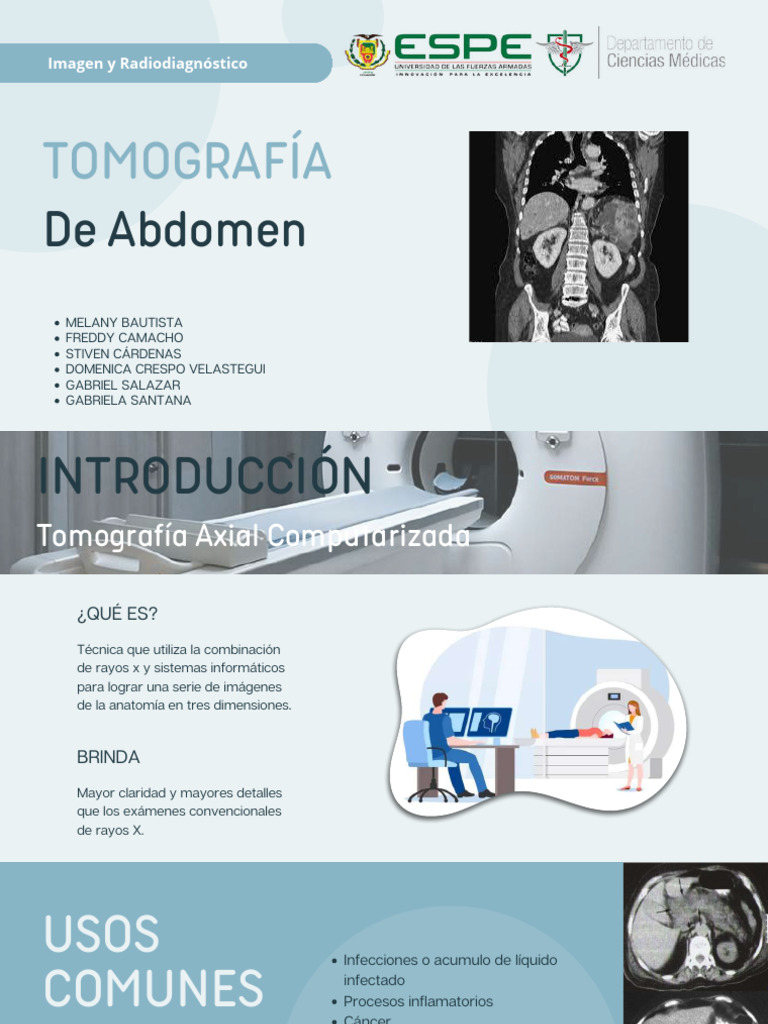 TAC ABDOMEN Compressed | PDF | Ct Scan | Abdomen