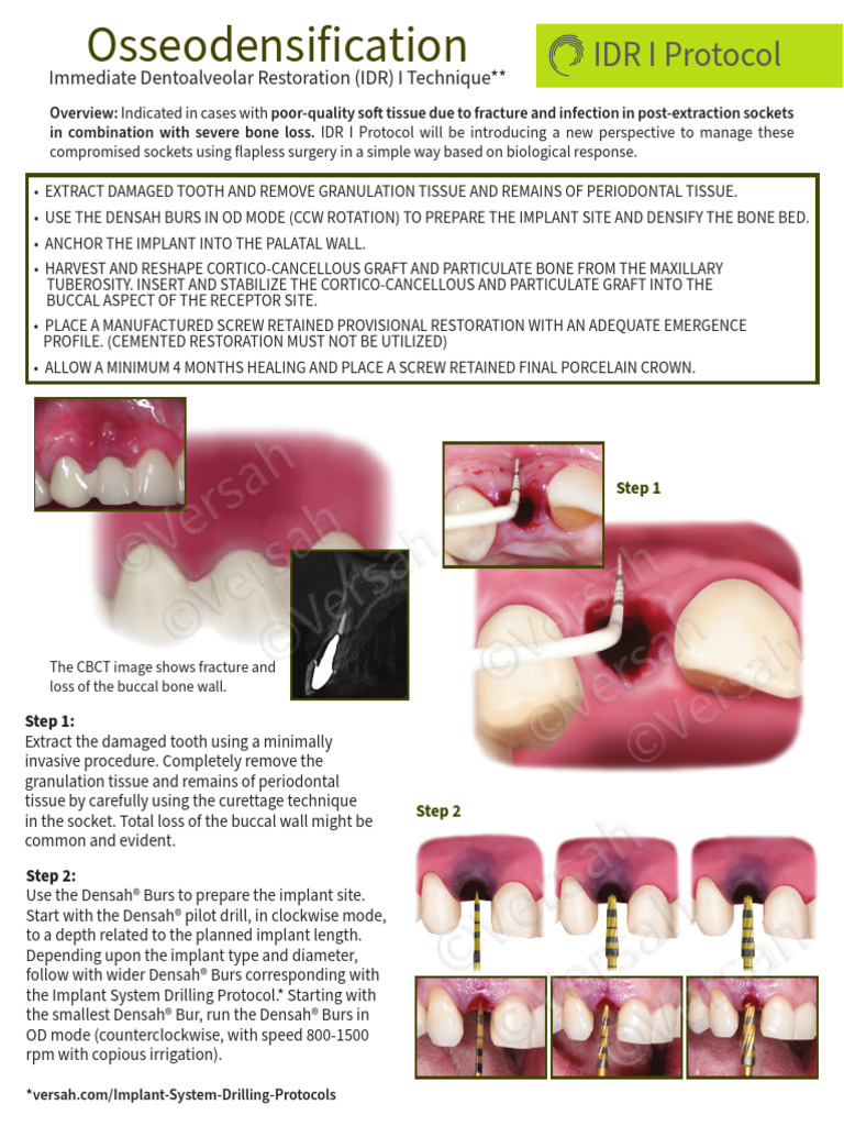 IDR_I_Protocol | PDF | Dental Implant | Dentistry