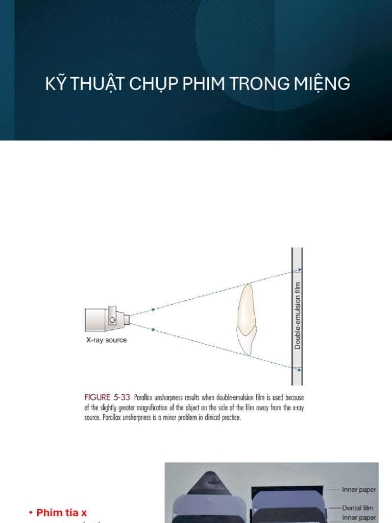 Kỹ Thuật Chụp Phim Trong Miệng | PDF