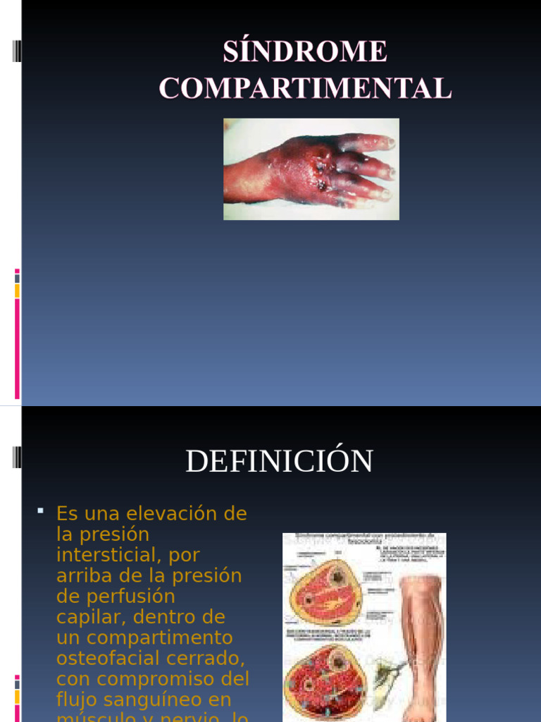 Síndrome Compartimental y Tratamiento | PDF