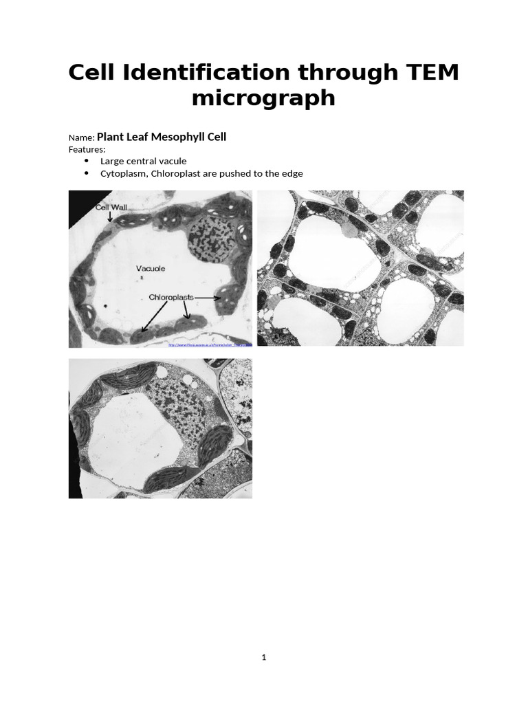Cell Identification Through TEM Micrograph | PDF