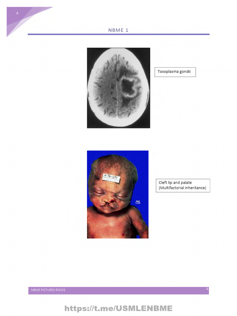 Images of NBME 1-30 | PDF | Esophagus | Kidney