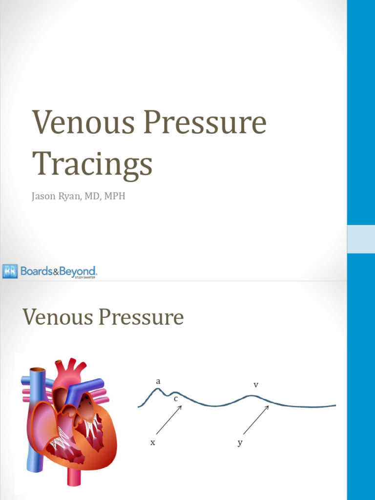 Venous Pressure Tracings Atf | PDF | Atrium (Heart) | Heart Valve