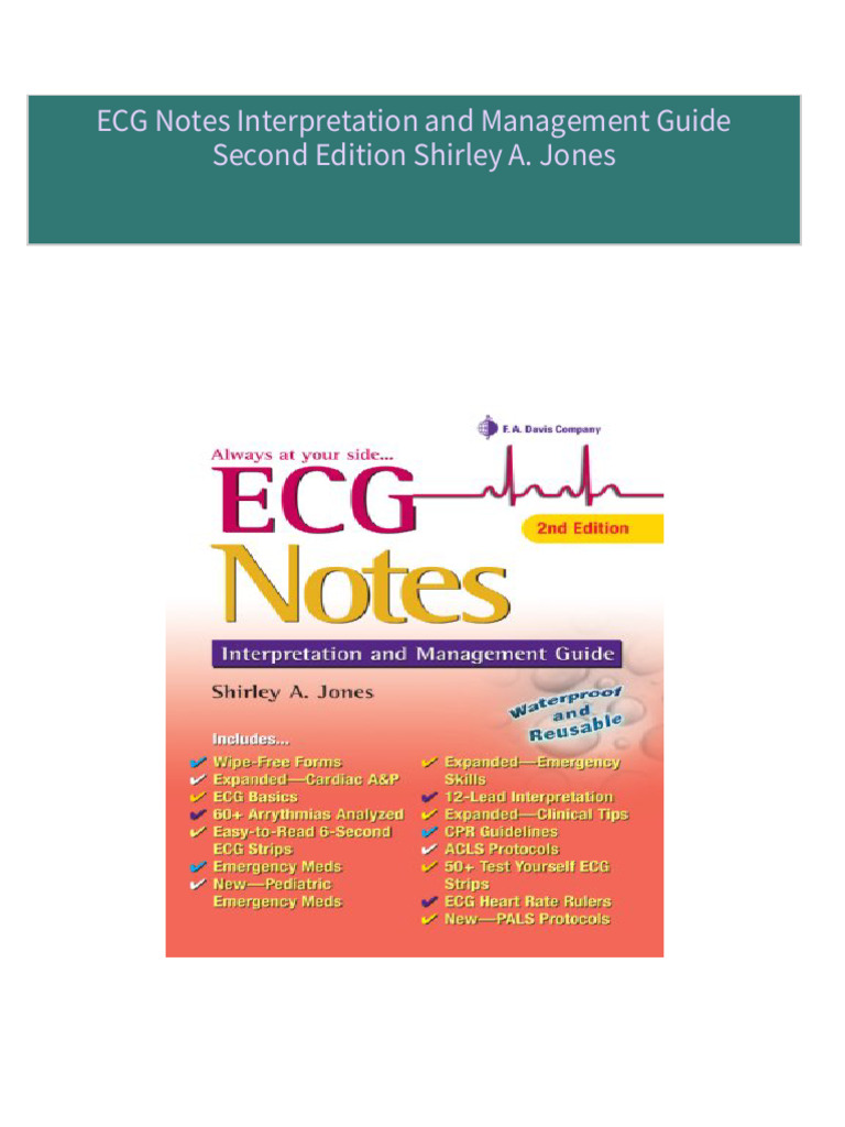 Download ebooks file ECG Notes Interpretation and Management Guide ... Download ebooks file ECG Notes Interpretation and Management Guide ...