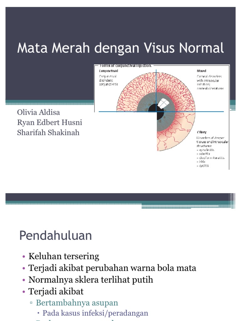 Mata Merah Dengan Visus Normal | PDF