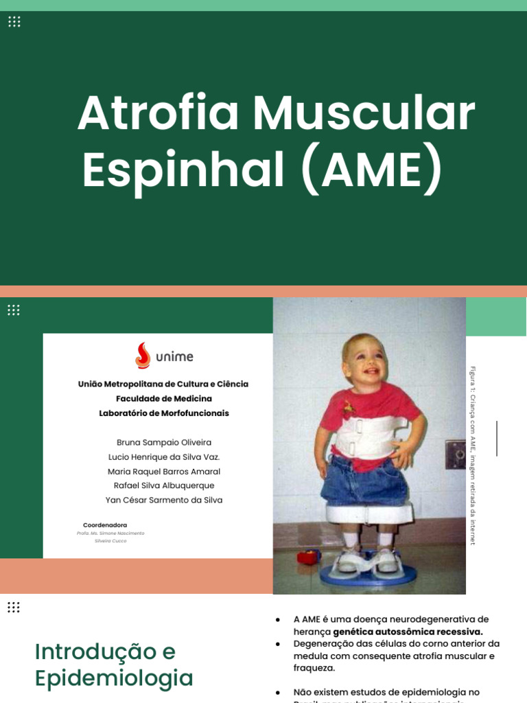 Atrofia Muscular Espinhal: Causas e Tipos | PDF | Genética | Proteínas