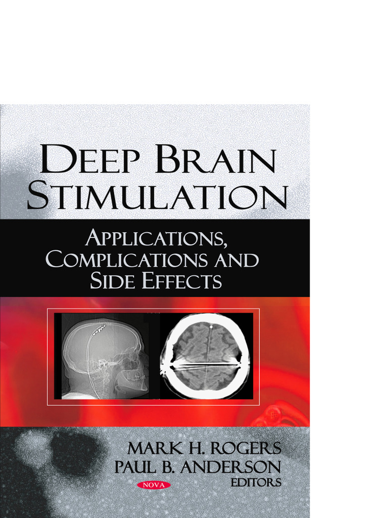 Vdoc.pub Deep Brain Stimulation Applications Complications and Side Effects | PDF | Basal ...