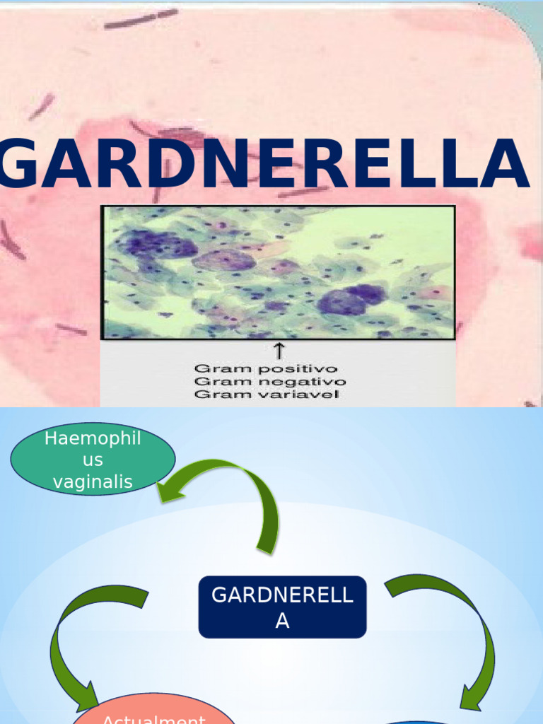 Gardnerella y Vaginitis Bacteriana | PDF
