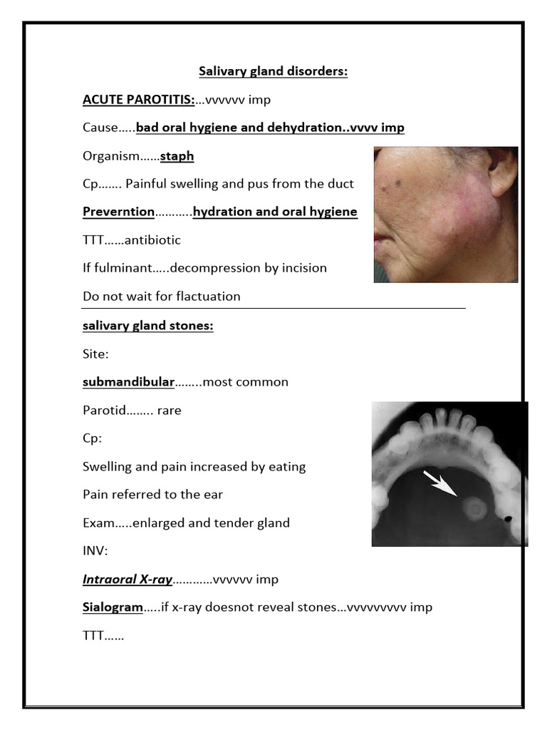 Salivary Gland Disorders Overview | PDF | Medical Specialties | Causes ...