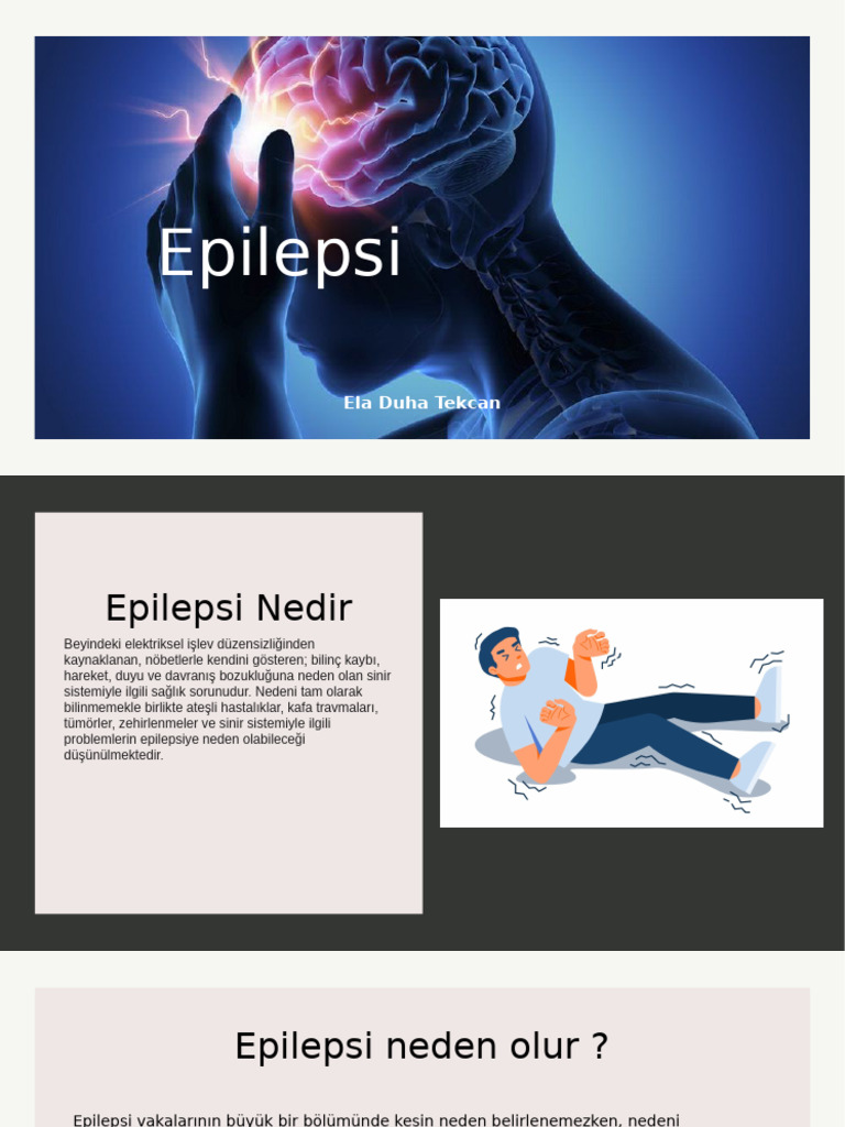 Epilepsi PWP | PDF