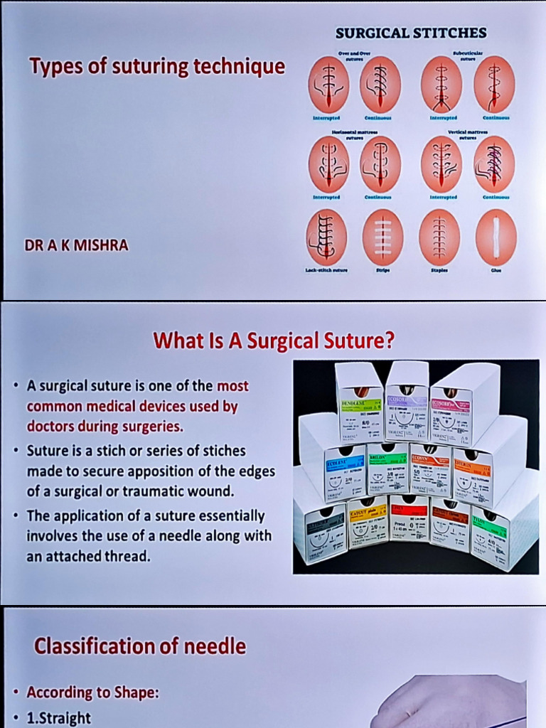 Types of Suturing Technique | PDF | Surgical Suture | Surgery