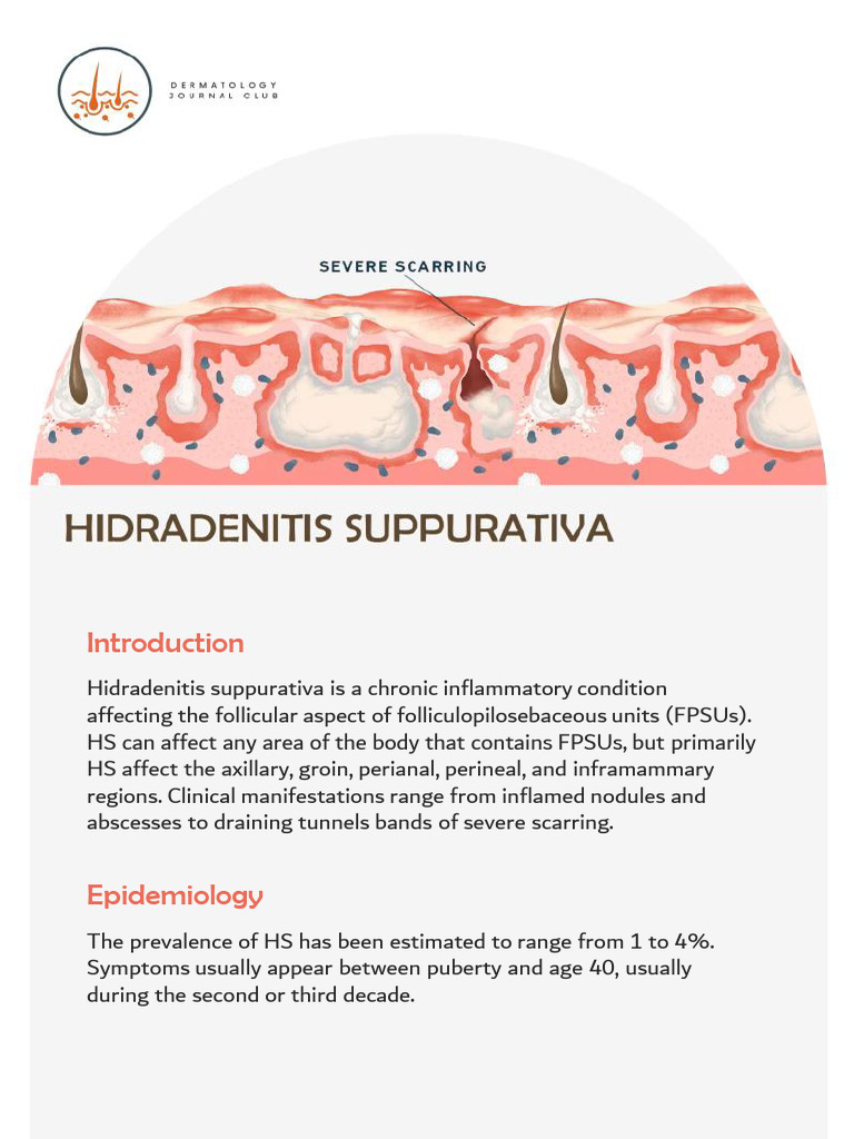 Hidradenitis Suppurativa Guide | PDF