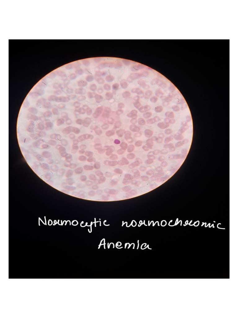 Pathology Spotters 1 | PDF