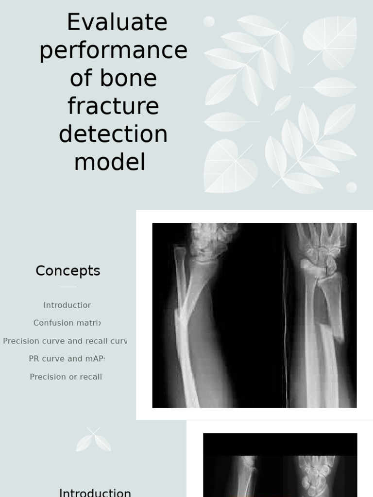 Bone Facture | PDF | Applied Mathematics | Cognitive Science