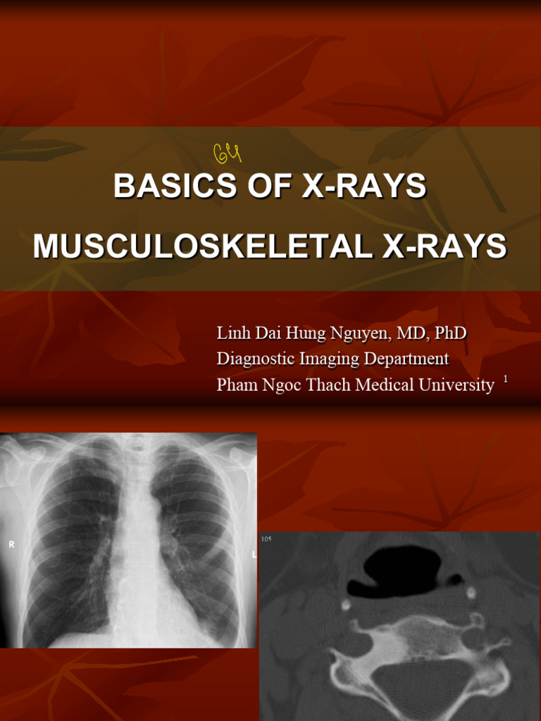 Musculoskeletal X-Ray Basics | PDF | Bone | X Ray