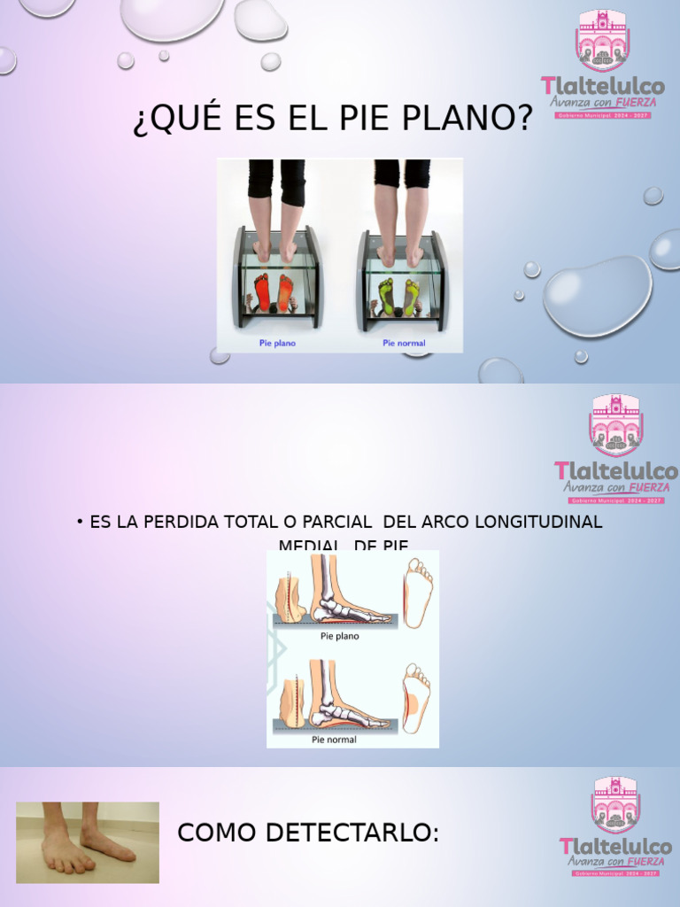 Qué Es El Pie Plano | PDF