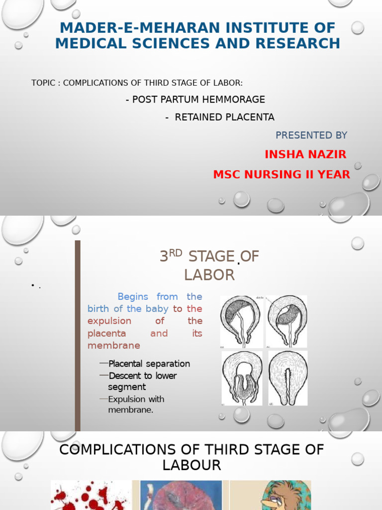 PPH.presentation | PDF | Childbirth | Clinical Medicine