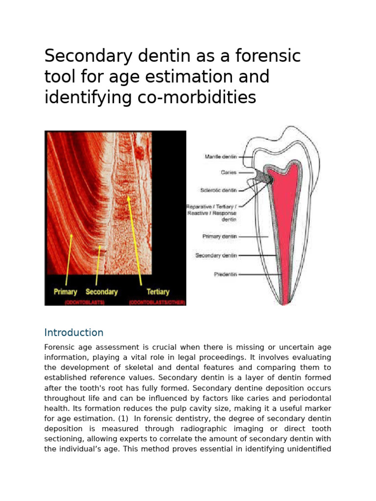 Secondary Dentin As A Forensic Tool For Age Estimation and Identifying ...