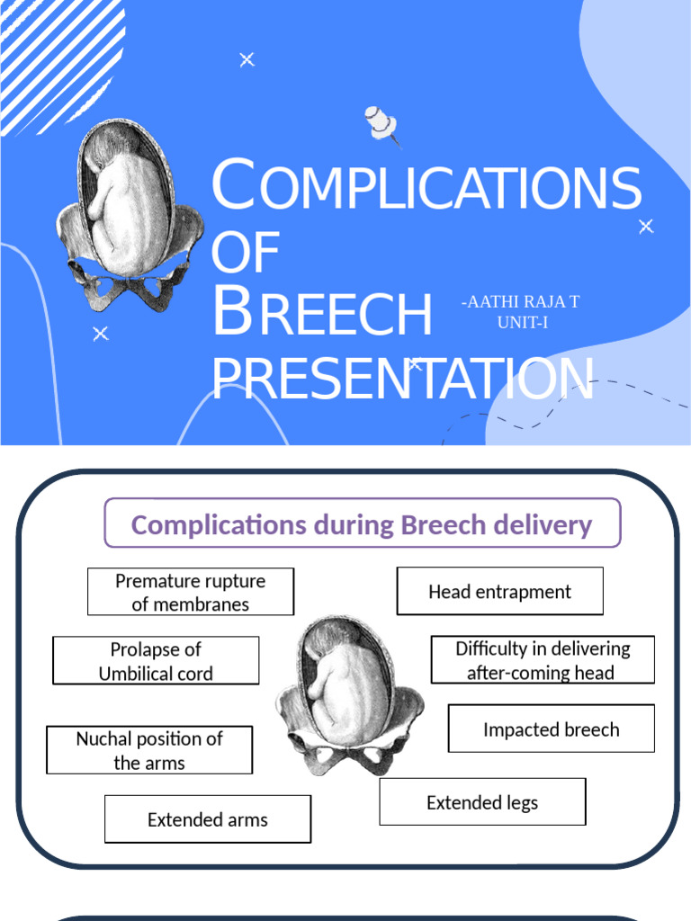 Complications of Breech Presentation | PDF | Childbirth | Motherhood