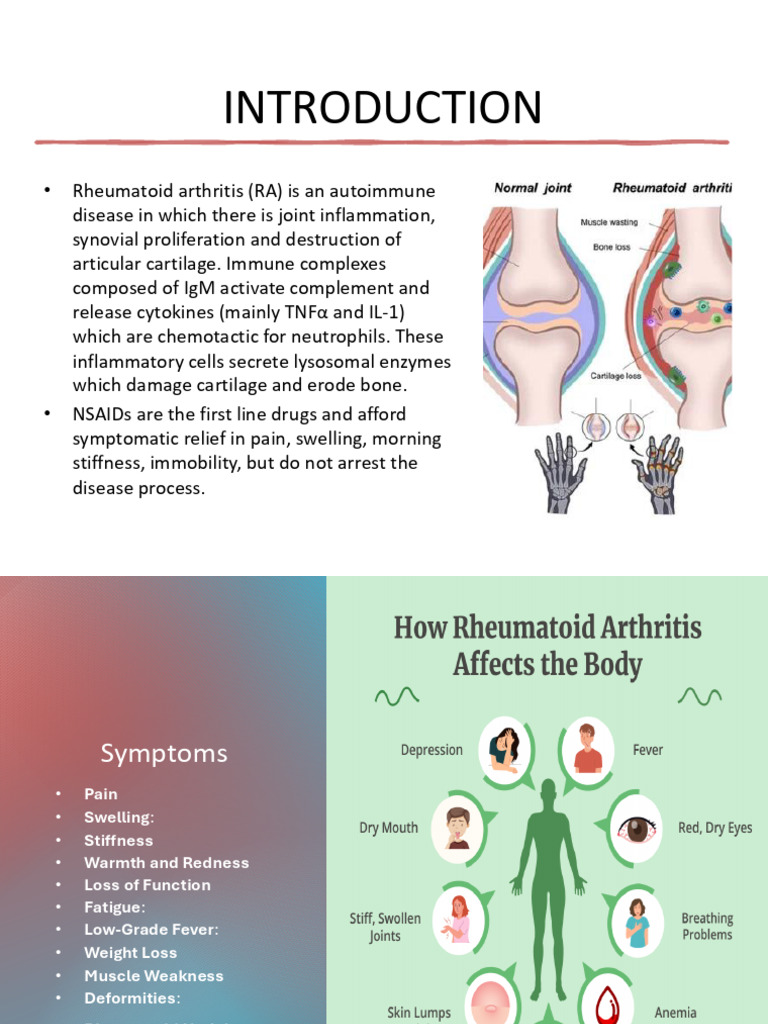 Rheumatoid Arthritis | PDF | Rheumatoid Arthritis | Arthritis