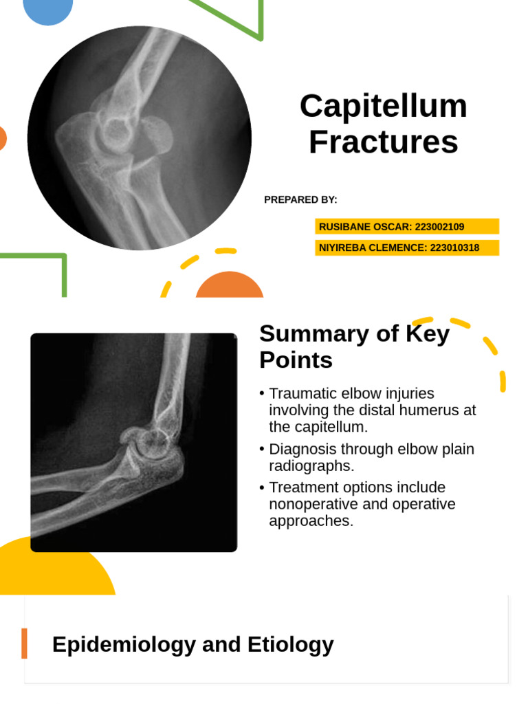 Capitellum Fractures 1 | PDF | Elbow | Skeletal System