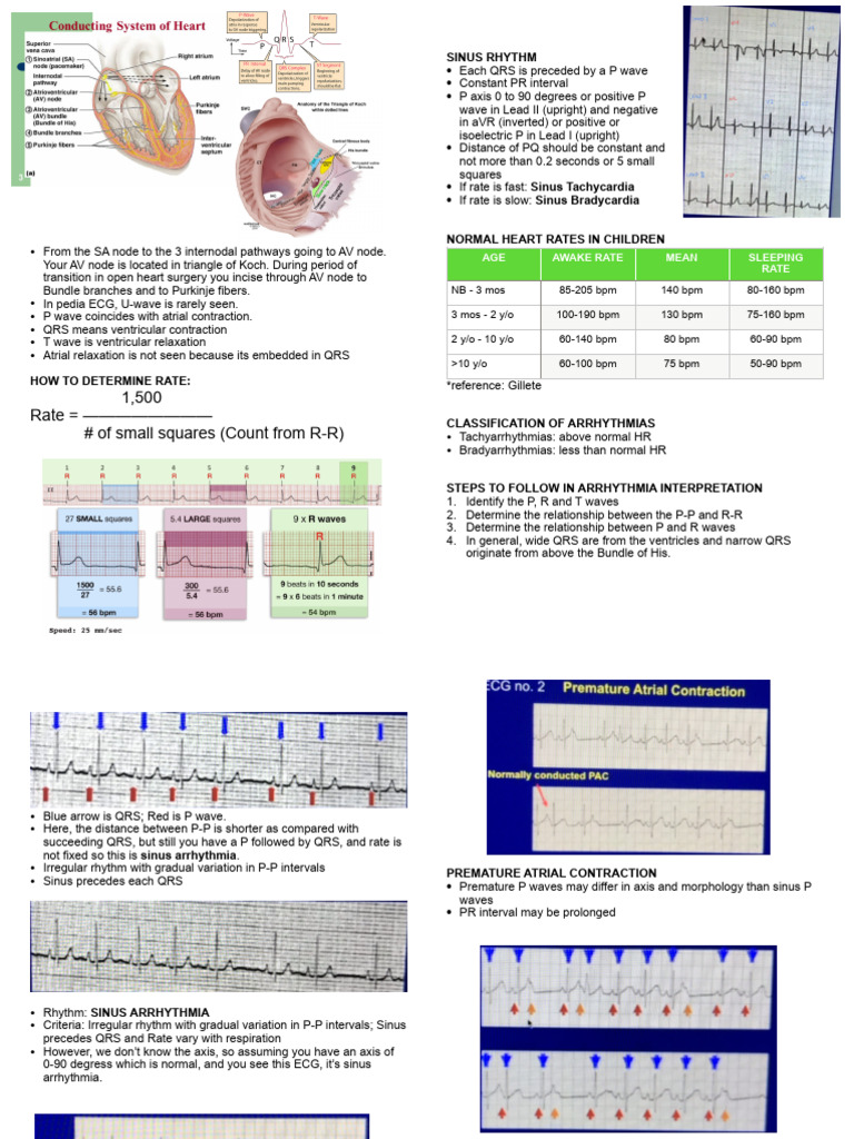 ECG | PDF | Heart Rate | Electrocardiography