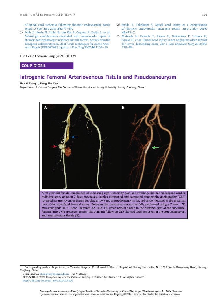 Fistula Arteriovenosa | PDF | Medical Specialties | Angiology