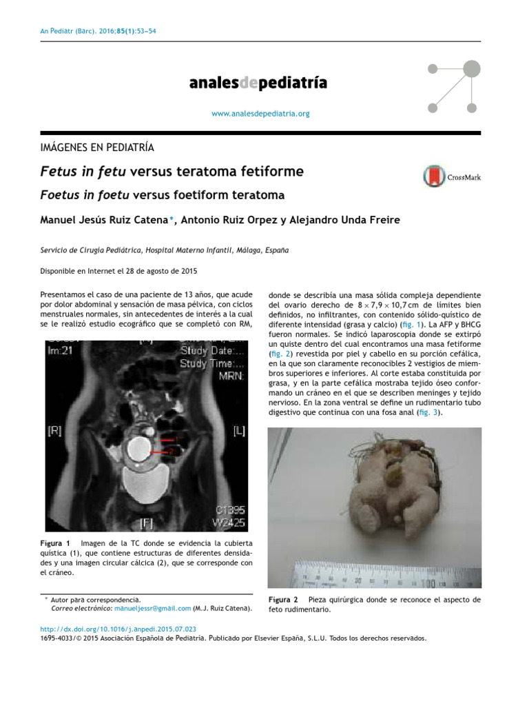 Fetus in fetu vs teratoma fetiforme | PDF | Medicina CLINICA ...