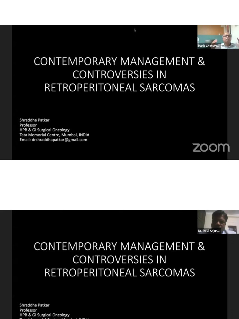 Retroperitoneal Sarcoma | PDF
