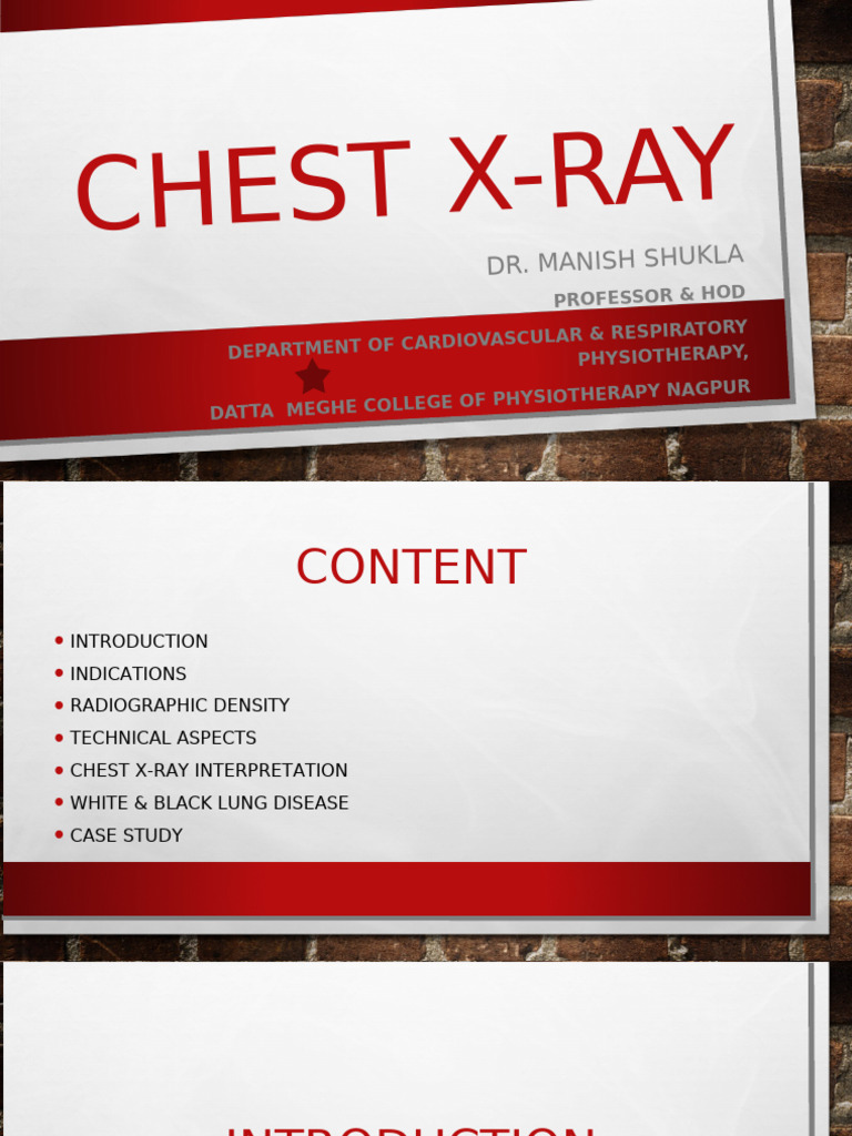 CHEST X-RAY | PDF