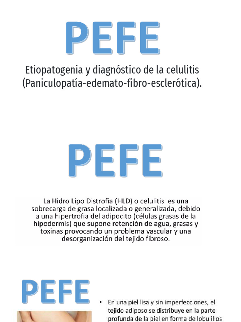 7 PEFE | PDF