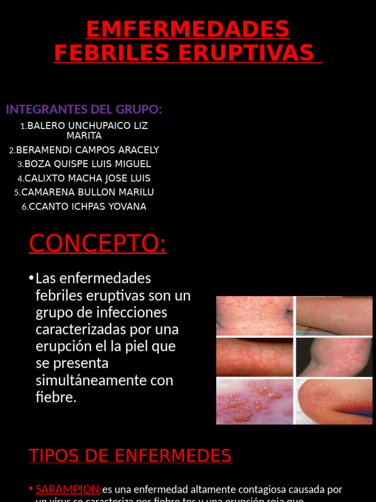 Enfermedades Febriles Erupitvas: Tipos y Síntomas | PDF