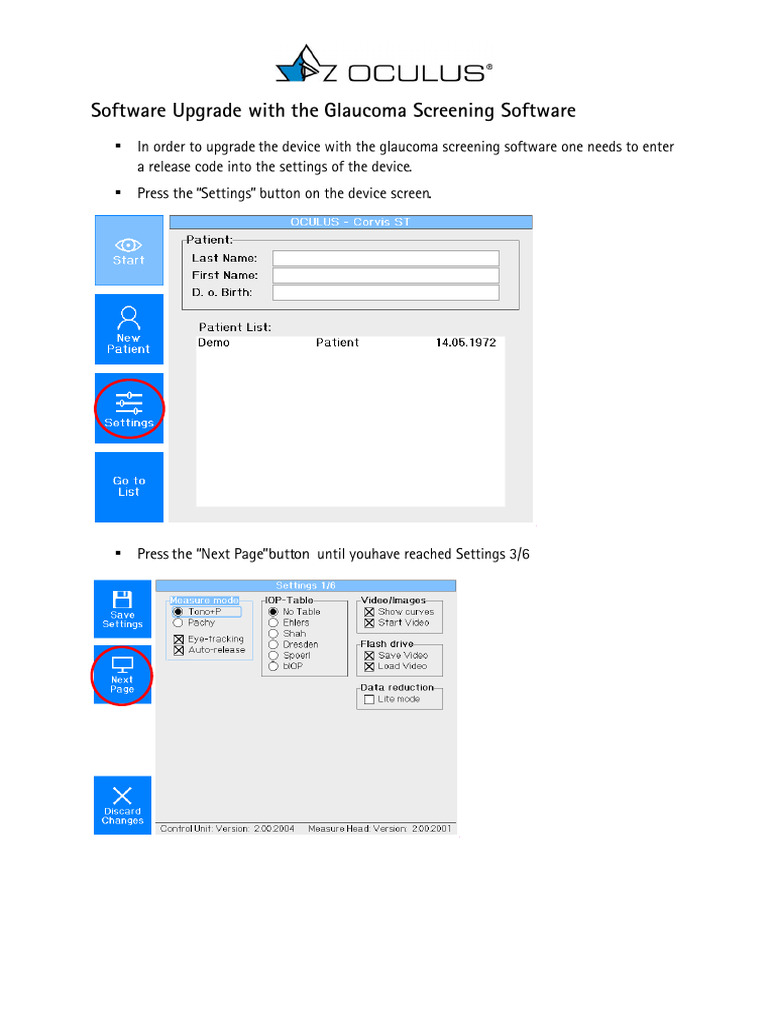 Upgrading Corvis ST Options | PDF