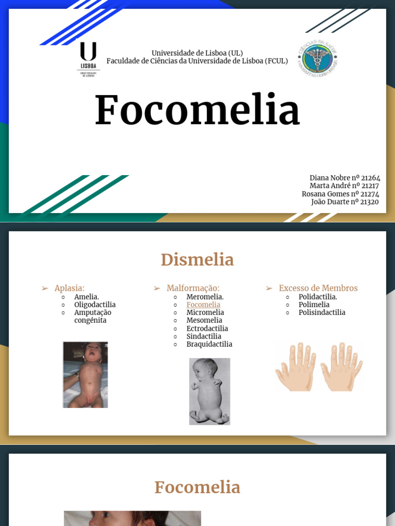 Focomelia Biologia do desenvolvimento | PDF | Medicina Veterinária ...