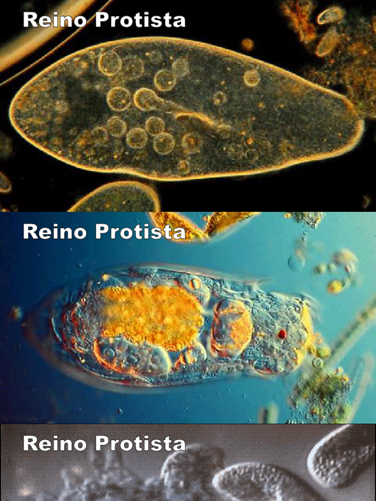Reino Protista (1) | PDF | Protozoários | Meiose